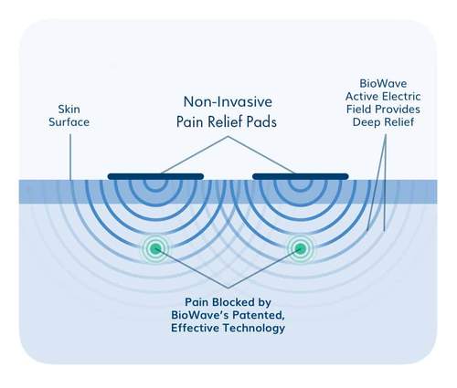 Pain Blocking Technology | BioWaveGO - BioWaveGO